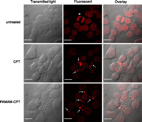 Nuclear Fragmentation And Apoptotic Body Formation In Hct 116 Cells Due