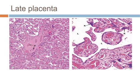 Histology Of The Placenta Pptx