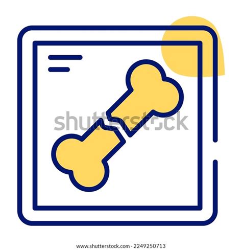Fractured Bone Showing On X Ray Stock Vector Royalty Free 2249250713