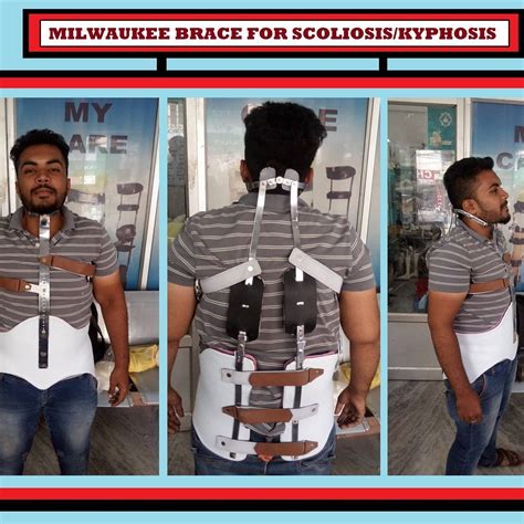 Milwaukee Brace Ctlso Manufacturers Milwaukee Brace Also Known As A