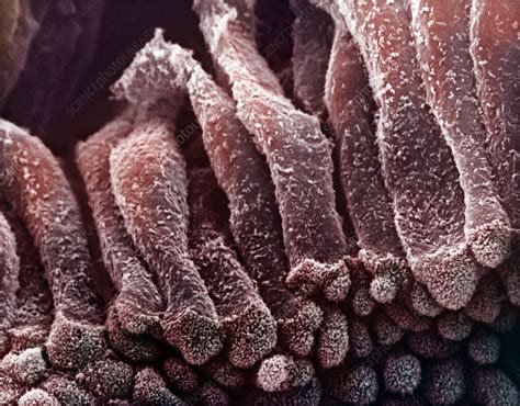 Epithelium Of The Gall Bladder Stock Image P530 0174 Science