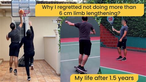 Why I Regretted Not Doing More Than Cm Limb Lengthening My Life After Years YouTube