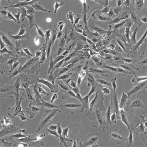 Human Choroid Plexus Epithelial Cells Innoprot Brain Cell System