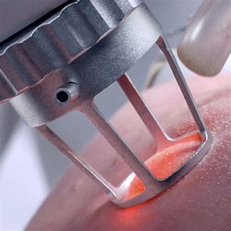 Premier Zero Pimple Premier Clinic