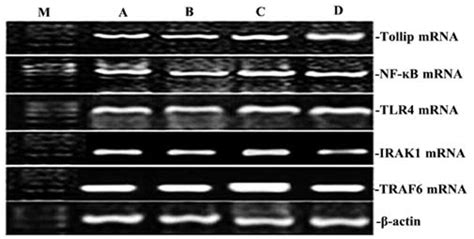 Effect Of Xbj On The Mrna Expression Of Tollip Irak1 Tlr4 Nf κb65
