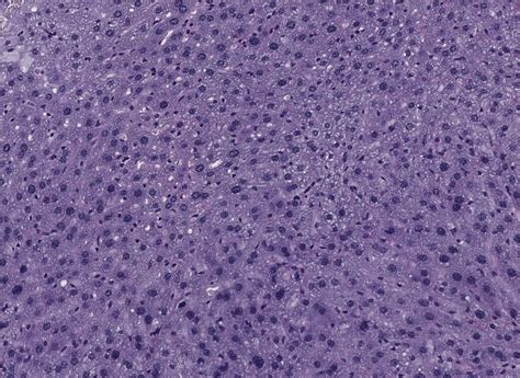 Aid In Analysis Of Pas Stained Slides Using Qupath Image Analysis Image Sc Forum