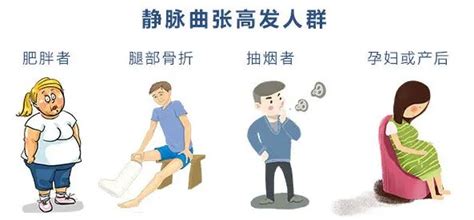 静脉曲张是怎么引起的原因症状怎么治疗 静脉曲张饮食上应该注意什么