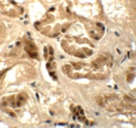 Atad3b Antibody Cat No 6389 Prosci