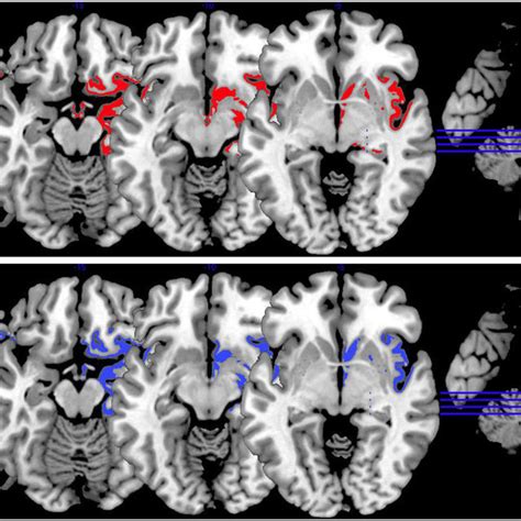 Face Affect Recognition Activations Overview Of The Working Memory Download Scientific