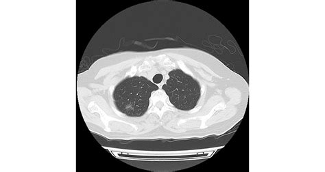 体内物質までも識別可能な次世代ct キヤノングローバル