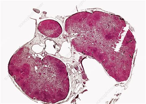 Lung Light Micrograph Stock Image C021 0007 Science Photo Library