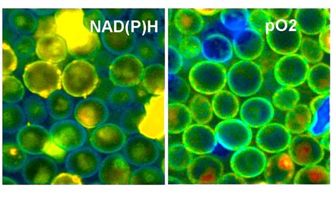 Simultaneous Metabolic Imaging And Po2 Imaging Becker And Hickl Gmbh