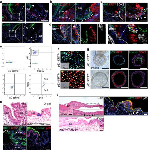 The Transitional Columnar Epithelium Is Present At The SCJ Of Normal Download Scientific