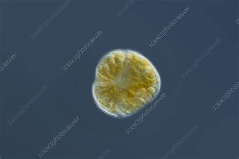 Alexandrium Tamutum Algae Light Micrograph Stock Image C059 8436 Science Photo Library