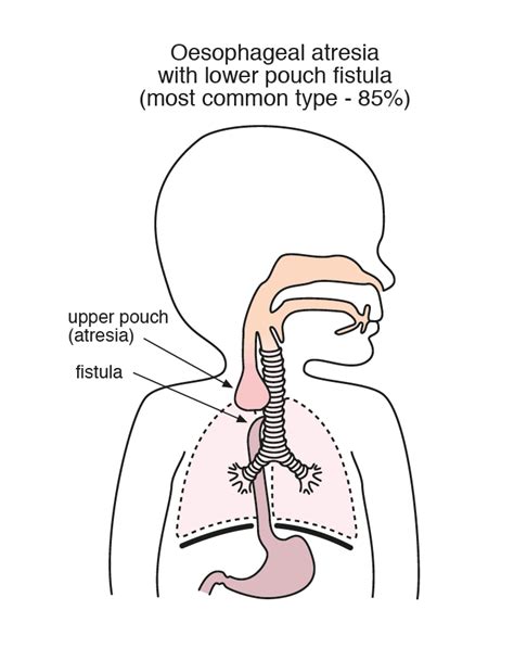 What Is Oa Tof Tofs Oa Tof Support