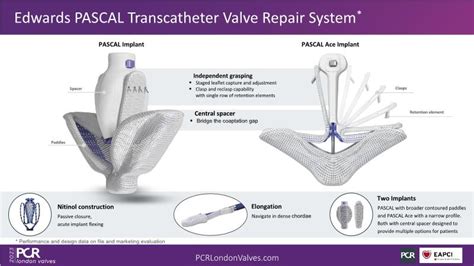 Advancing Valve Repair Mastering Diverse Mitral And Tricuspid Regurgitation Anatomies With The