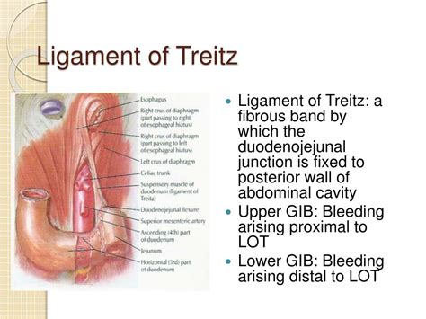 Ligament Of Treitz Upper Gi