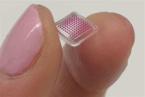 Microneedle Patch Designed To Sock It To Skin Infections