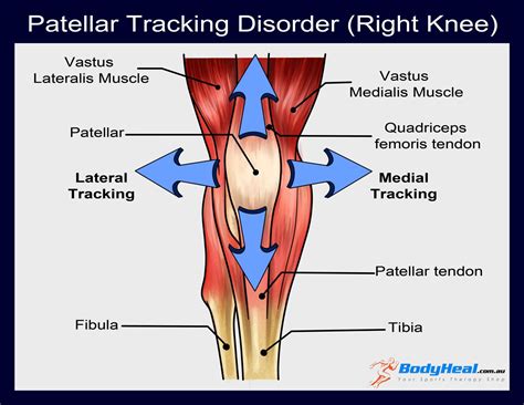 Patellar Tracking Test