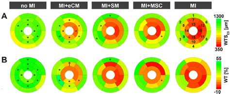 Assessment Of Regional Contractile Function By Mri Regional Download Scientific Diagram
