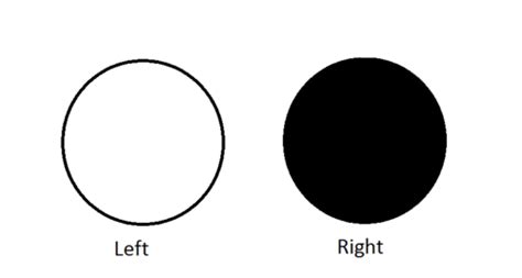 Visual Field Defects Flashcards Quizlet Visual Field Defects Flashcards Quizlet