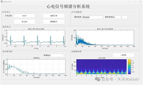 【心电信号】心电信号频谱分析附matlab代码傅里叶变换将心电信号生成频谱图的原理 Csdn博客