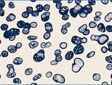 Rna Seq Basics Applications And Protocol Rna Seq Blog
