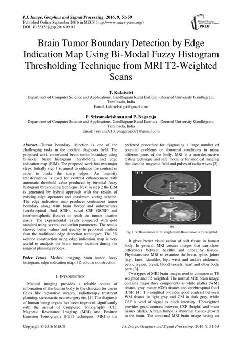 Pdf Brain Tumor Boundary Detection By Edge Indication Map Using Bi Modal Fuzzy Histogram