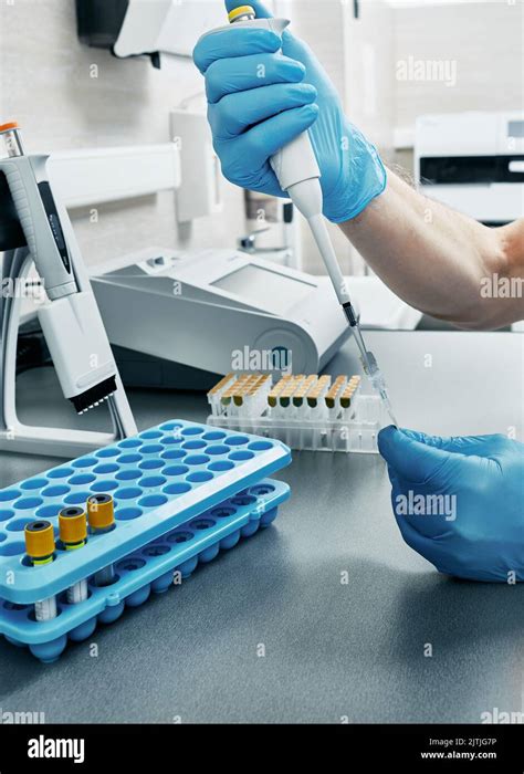 Laboratory Technician With Micropipette For Test Analyzes Determines Person S Blood Type Using