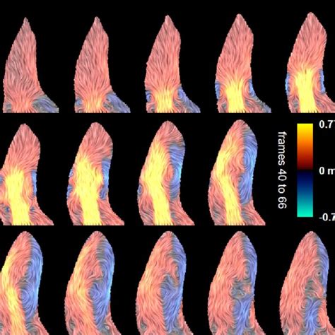 Physics Constrained Intraventricular Vector Flow Mapping Ivfm In A