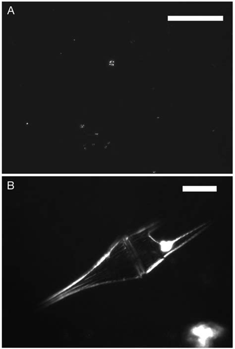 A Birefringence Microscopy Image Of Detached Coccoliths And Plated