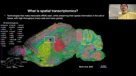 W31 Spatial Transcriptomics Day 1 Youtube