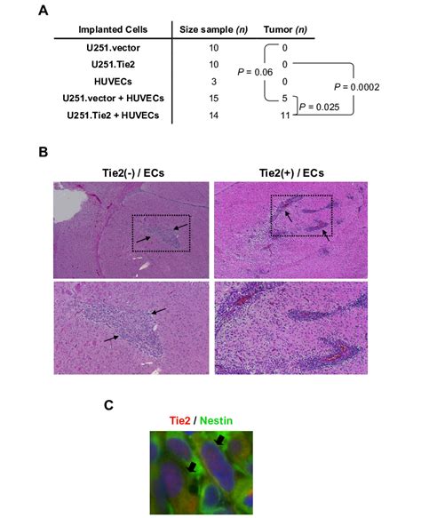Role Of The Interaction Of Tie2 Glioma Cells With Ecs In Gliomagenesis Download Scientific
