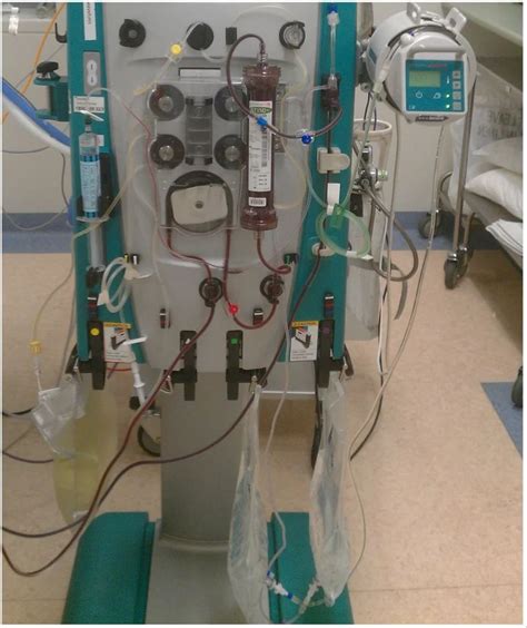Baxter Prismaflex Crrt Machine At ₹ 1800000 In Hyderabad Id
