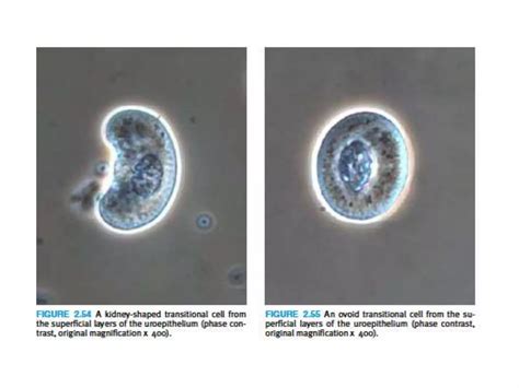 Urine Microscopy Ppt