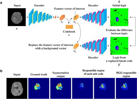 Observing Deep Radiomics For The Classification Of Glioma Grades Pmc