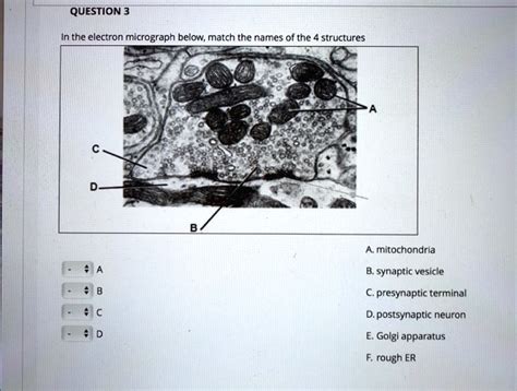 Solvedquestion 3 In The Ectron Micrograph Below Match The Names Of The Structures A