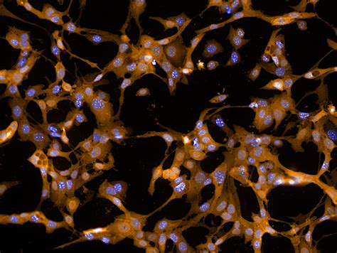 Cell Based Assay Services Oncodesign Services