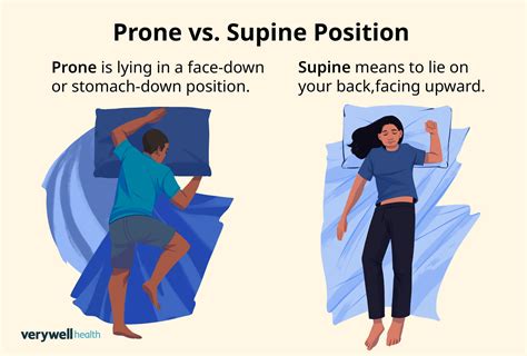 Supine Causes Symptoms Treatment Supine