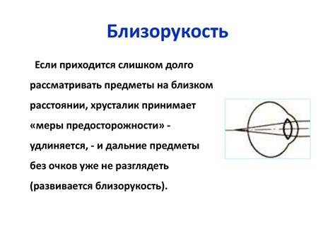 Зрение и его дефекты презентация онлайн