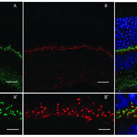 Dystrophin Expression In The Mouse Retina Is Localized To The Outer Download Scientific Diagram