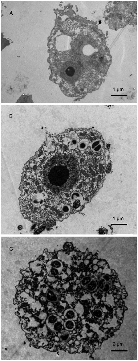 Electron Microscope Image Showing The Intracellular Localisation Of V