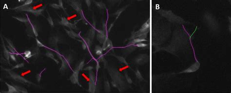 Morphological Parameters Analyzed A Tracing Of Primary Neurite Download Scientific Diagram