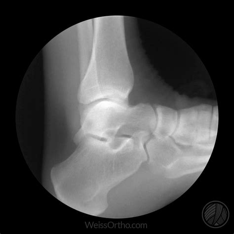 Human Skeletons Come To Life In These Amazing X Ray S