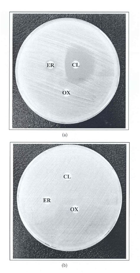 Example Of Double Disk Test D Test Demonstrating Erythromycin Er Download Scientific