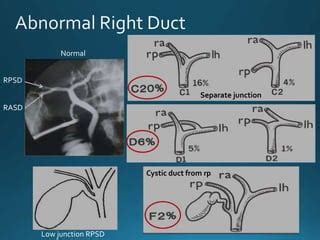 Biliary Anatomy And Reconstruction Of The Biliary Tract PPT
