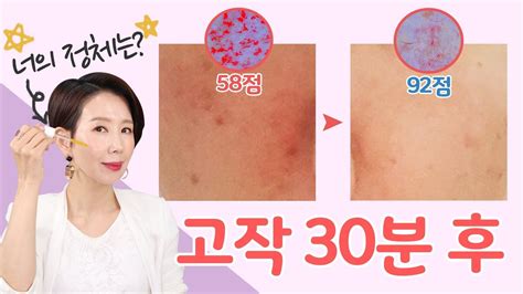 Eng 피부장벽 즉시 세워드림 딱 2가지로 회복 앰플 만들기 By 디렉터파이 Youtube