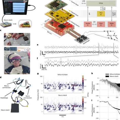 Neuro Stack As A Programmable Closed Loop Neuromodulation System A