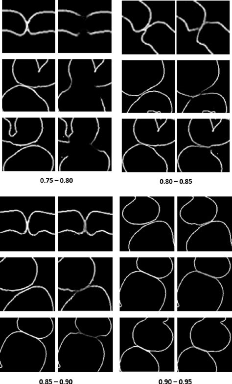 Figure 1 From Tooth Segmentation Of 3d Scan Data Using Generative