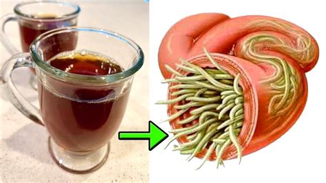 Natural Ways To Get Rid Of Intestinal Worms In No Time No Need To Be